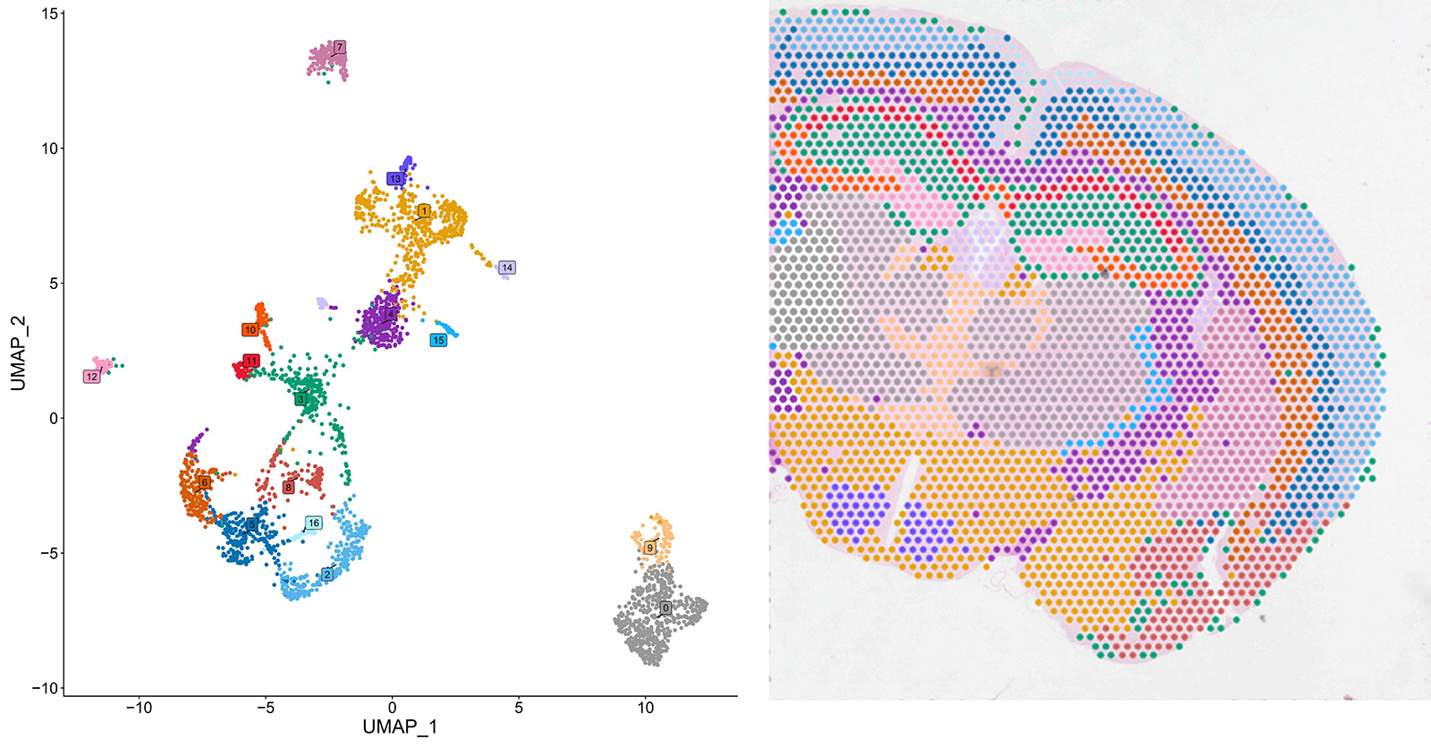 Redefining Spatial Transcriptomics: M20 Spatial - M20 Genomics