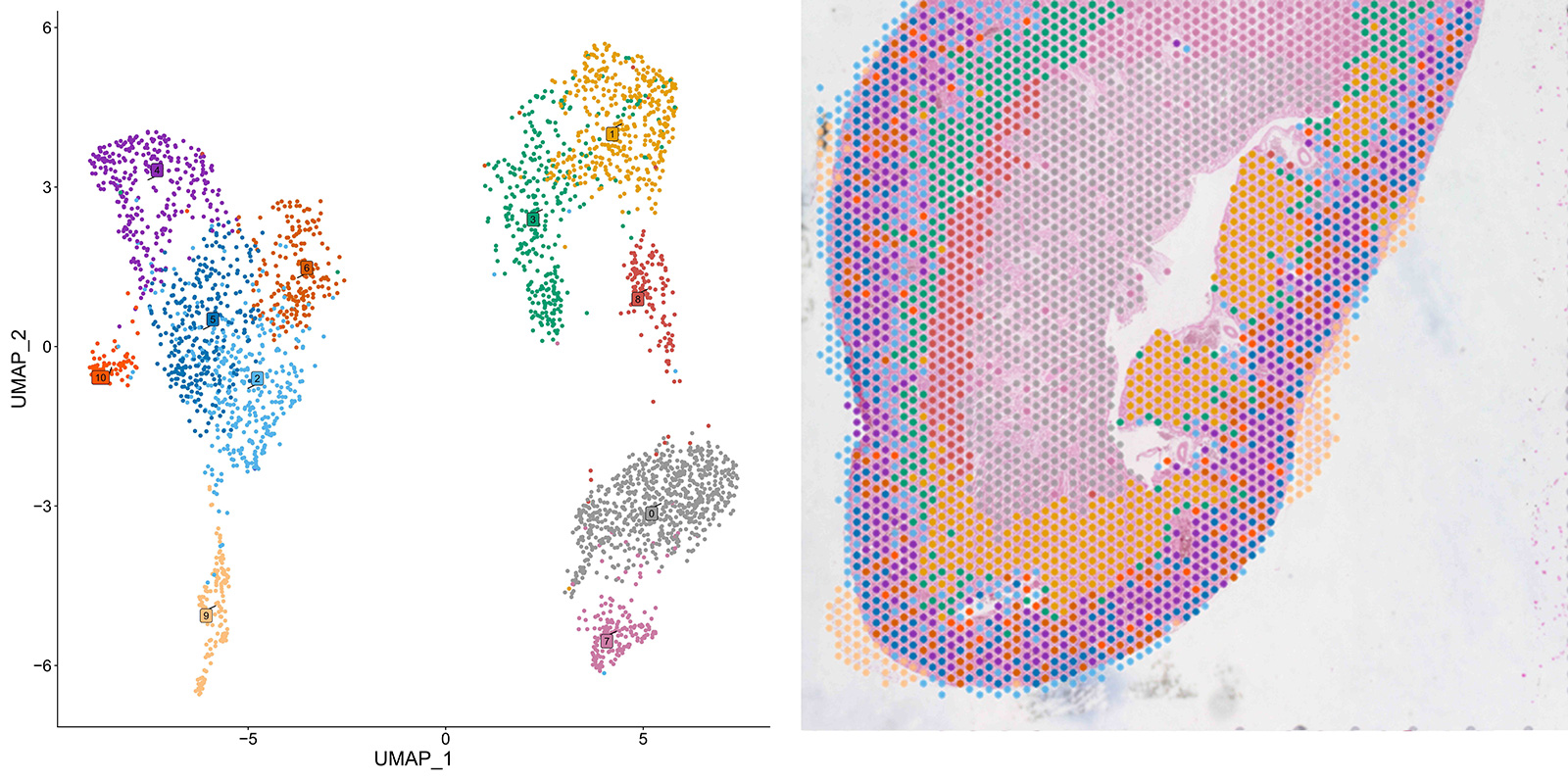Redefining Spatial Transcriptomics: M20 Spatial - M20 Genomics