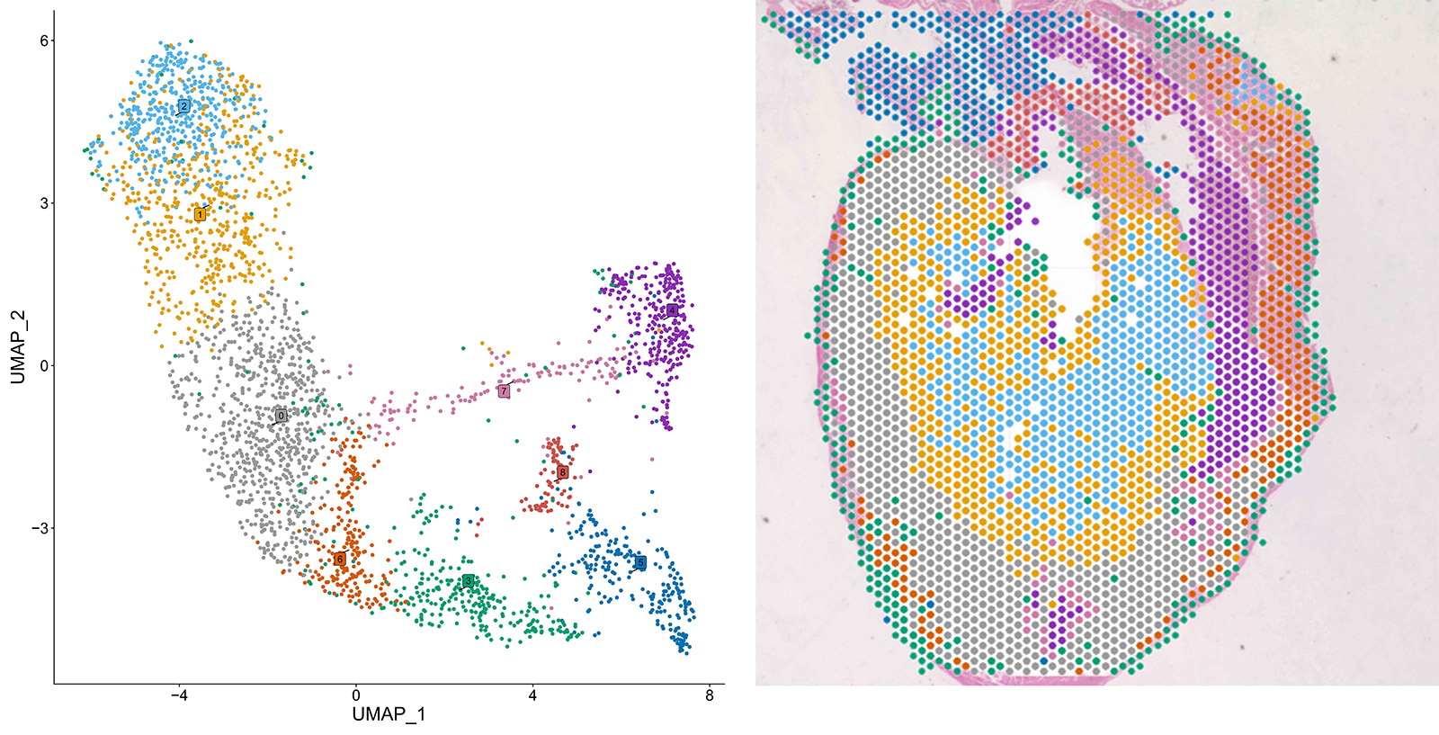 Redefining Spatial Transcriptomics: M20 Spatial - M20 Genomics