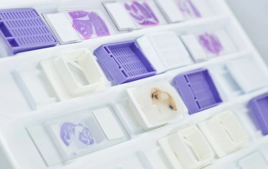 Unveiling Cellular Mysteries: The Power of Single-Cell Sequencing with ...